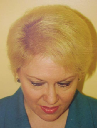 Phonophoresis - Neotis - Neotis